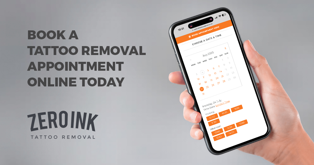 Book Online | Zero ink Tattoo Removal
